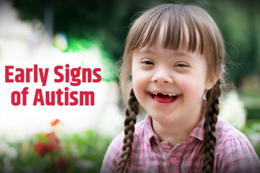 Early Signs of Autism: Understanding and Managing Autism Spectrum ...