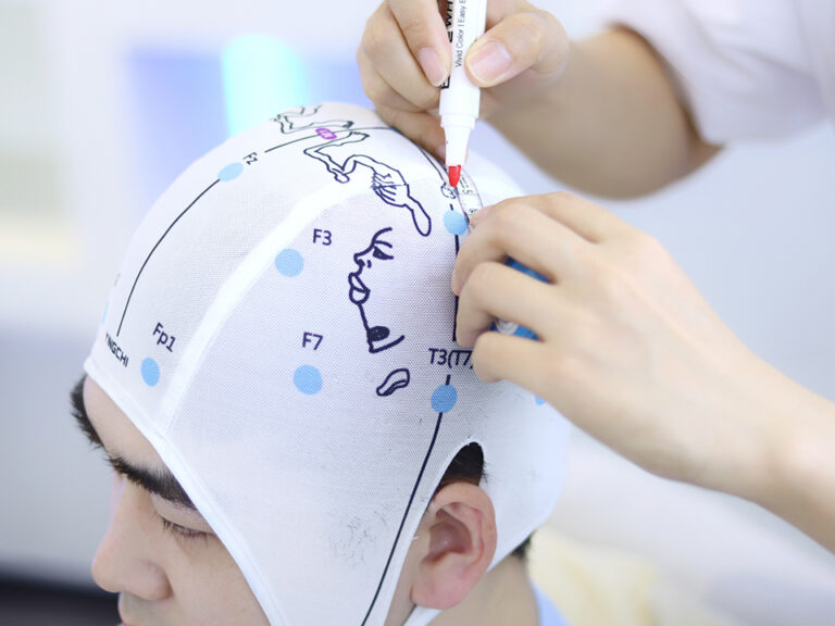 The 10–20 System in rTMS: From Scalp Landmarks to Targeted Brain ...